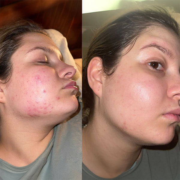 Ultimate Biome Spritz - BB 07/26 - Clémence Organics